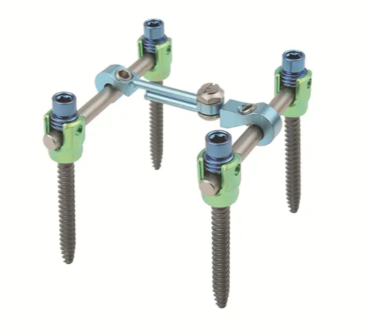 Enhancing Spinal Care with WEGO Medical’s Modular Spinal Fixation ...